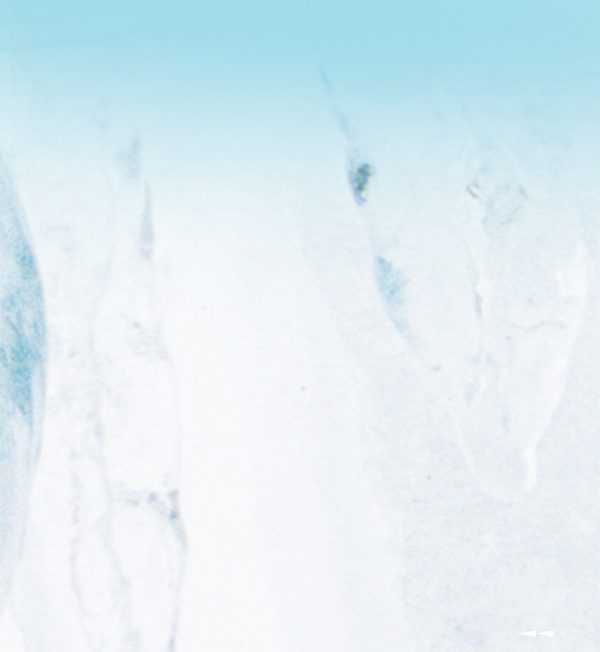 Cole Navin - The North Face